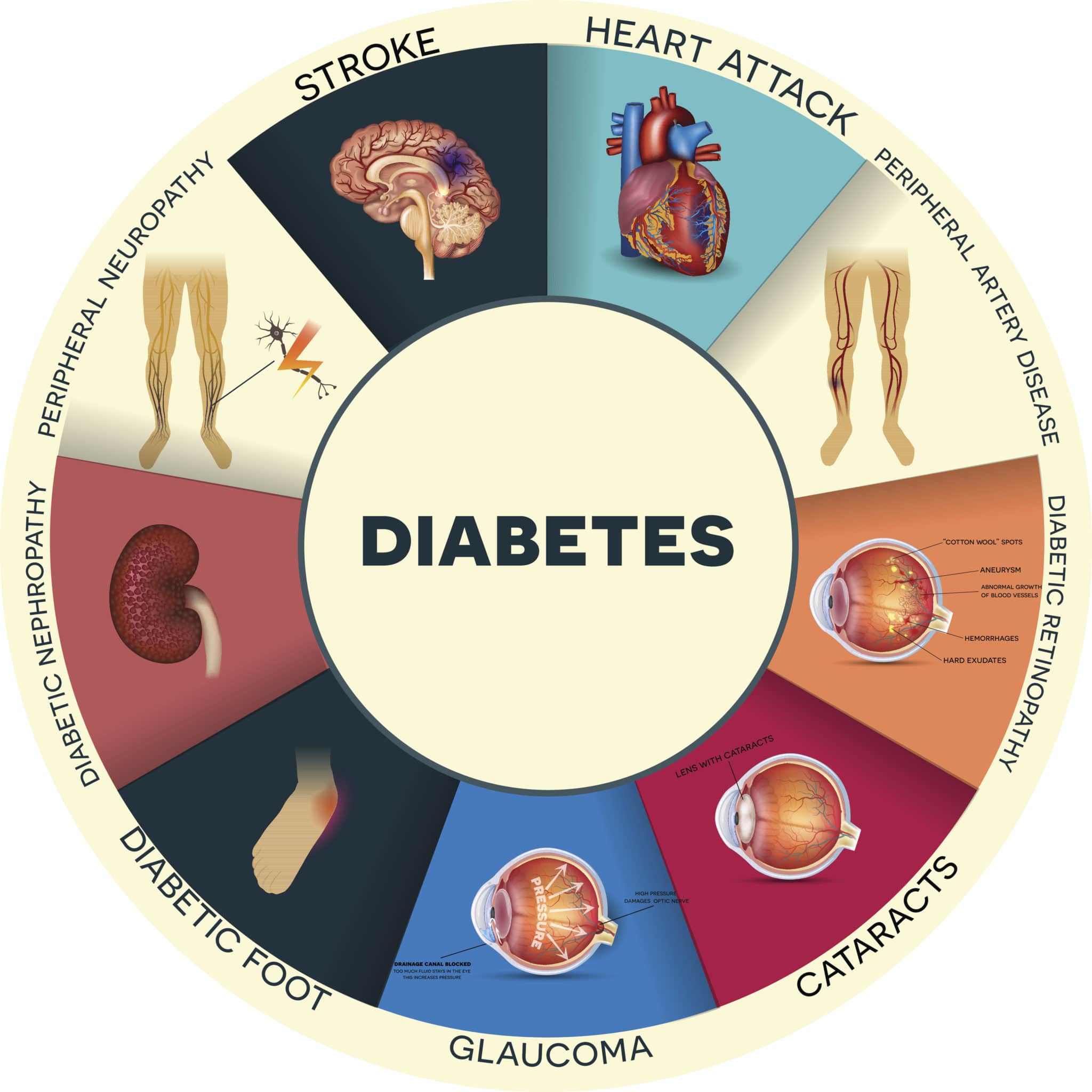 How Diabetes Affects the Body Long-Term - Life Line Screening