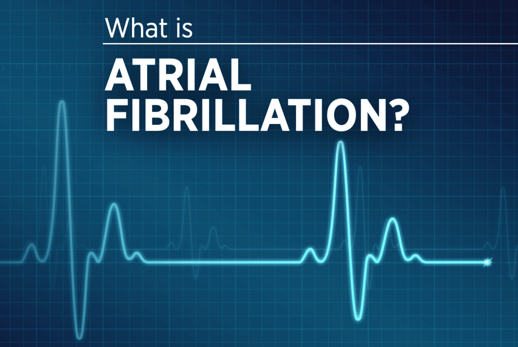Atrial Fibrillation - Life Line Screening